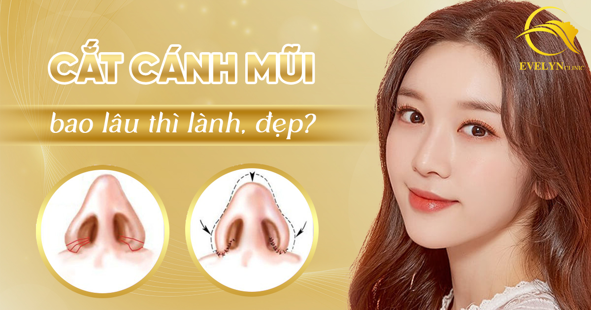 Cắt cánh mũi bao lâu thì lành, đẹp? Giải đáp cùng chuyên gia