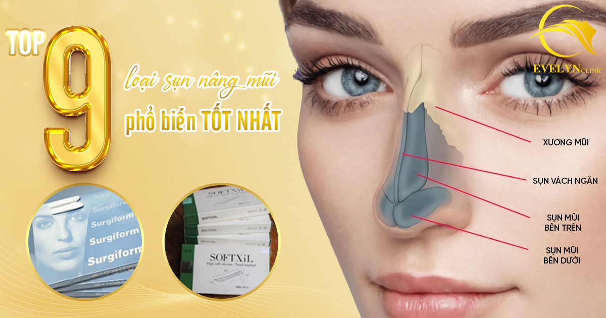 TOP 9 loại sụn nâng mũi phổ biến TỐT NHẤT hiện nay